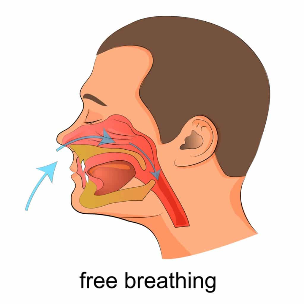 Orofacial Myofunctional Therapy | MarvelMyo & Speech